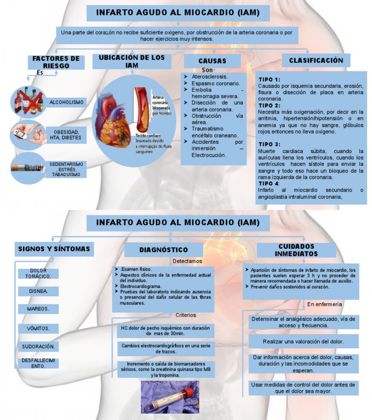 Infarto Agudo Al Miocardio | PDF | Infarto de miocardio | Ciencias de ...