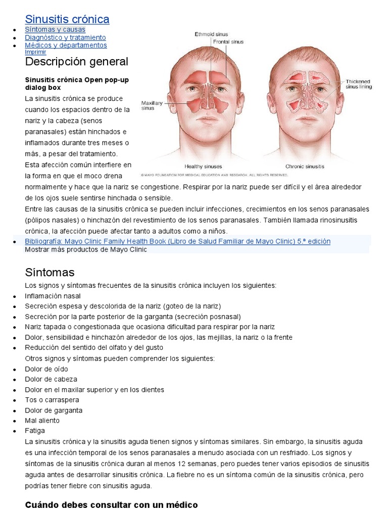 Sinusitis Crónica | PDF | Alergia | Resfriado comun