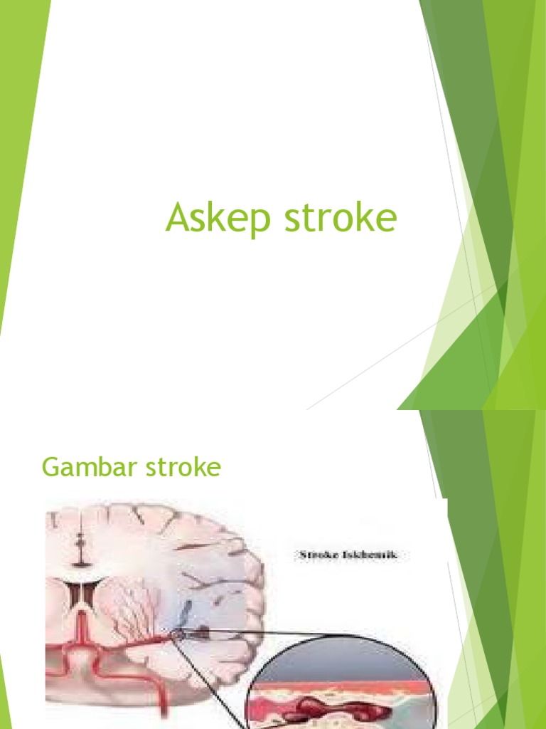 Askep Stroke | PDF