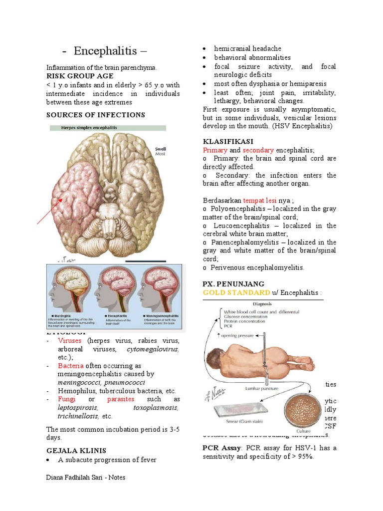 Encephalitis | PDF