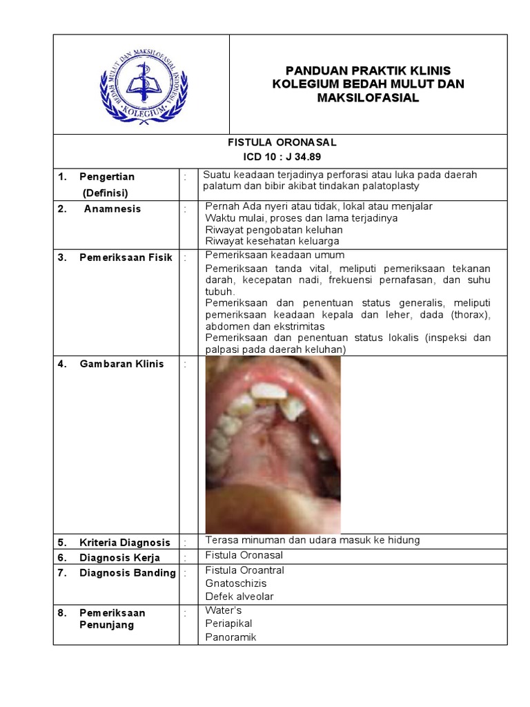 PPK Gigi - Fistula Oronasal | PDF