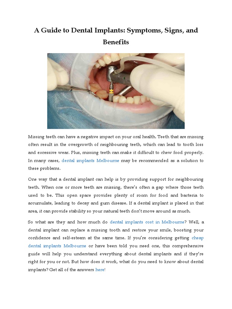 A Guide To Dental Implants: Symptoms, Signs, and Benefits | PDF