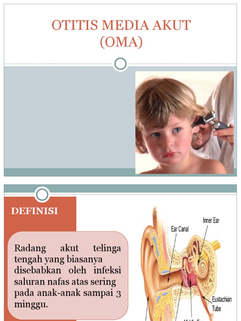 Otitis Media Akut (OMA) | PDF