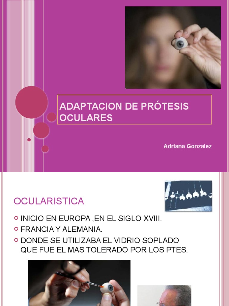 Adaptación de Prótesis Oculares | PDF | Dentadura postiza | Ojo humano