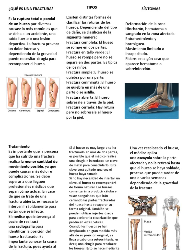 Fracturas | PDF | Hueso | Fractura