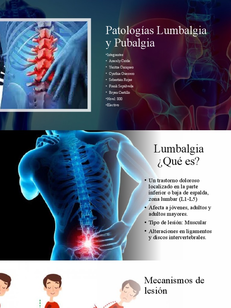 Lumbalgia y Pubalgia: Síntomas y Causas | PDF | Dolor lumbar ...