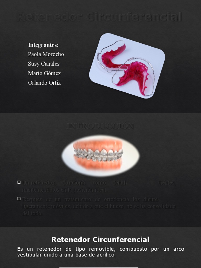 Retenedor Circunferencial B | PDF | Odontología | Ortodoncia