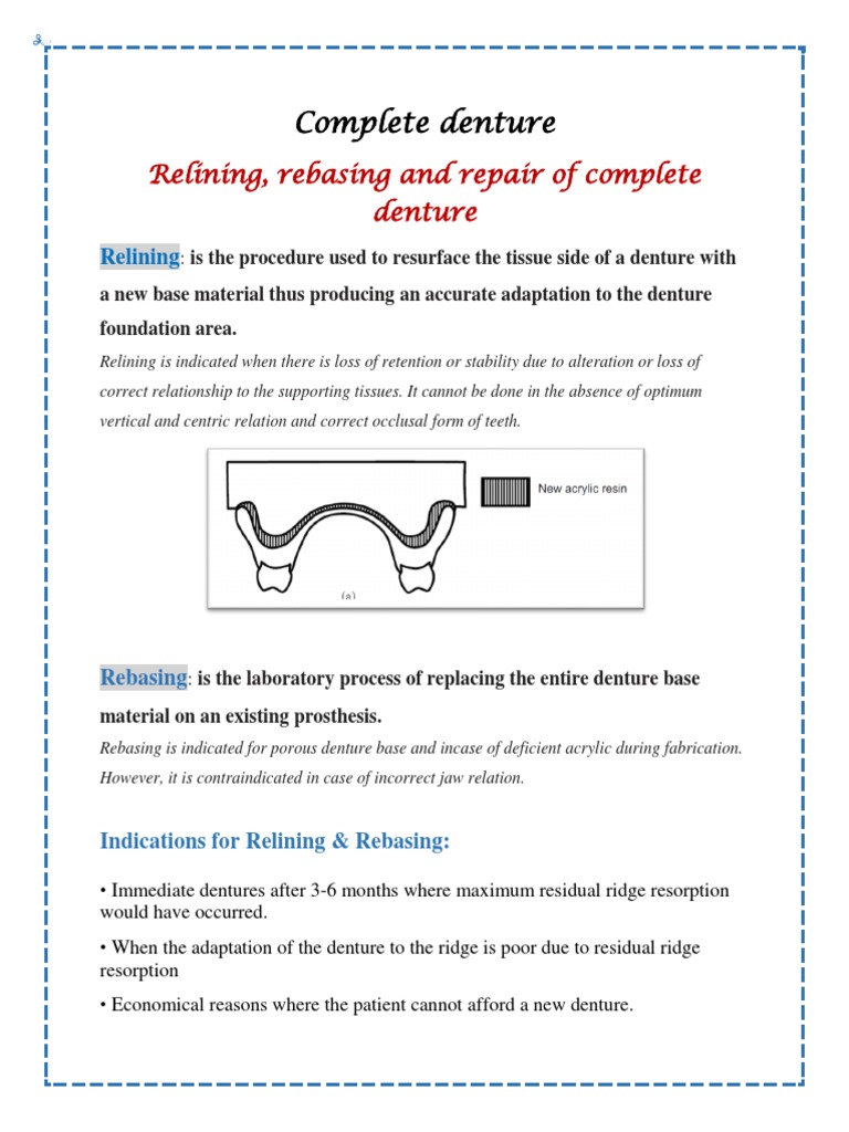 Relining and Rebasing Complete Dentures | PDF | Dentures | Plaster