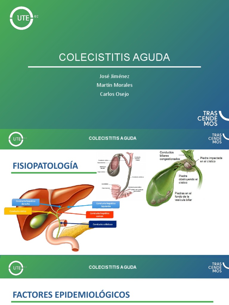 Colecistitis Aguda | PDF | Medicina CLINICA | Medicina