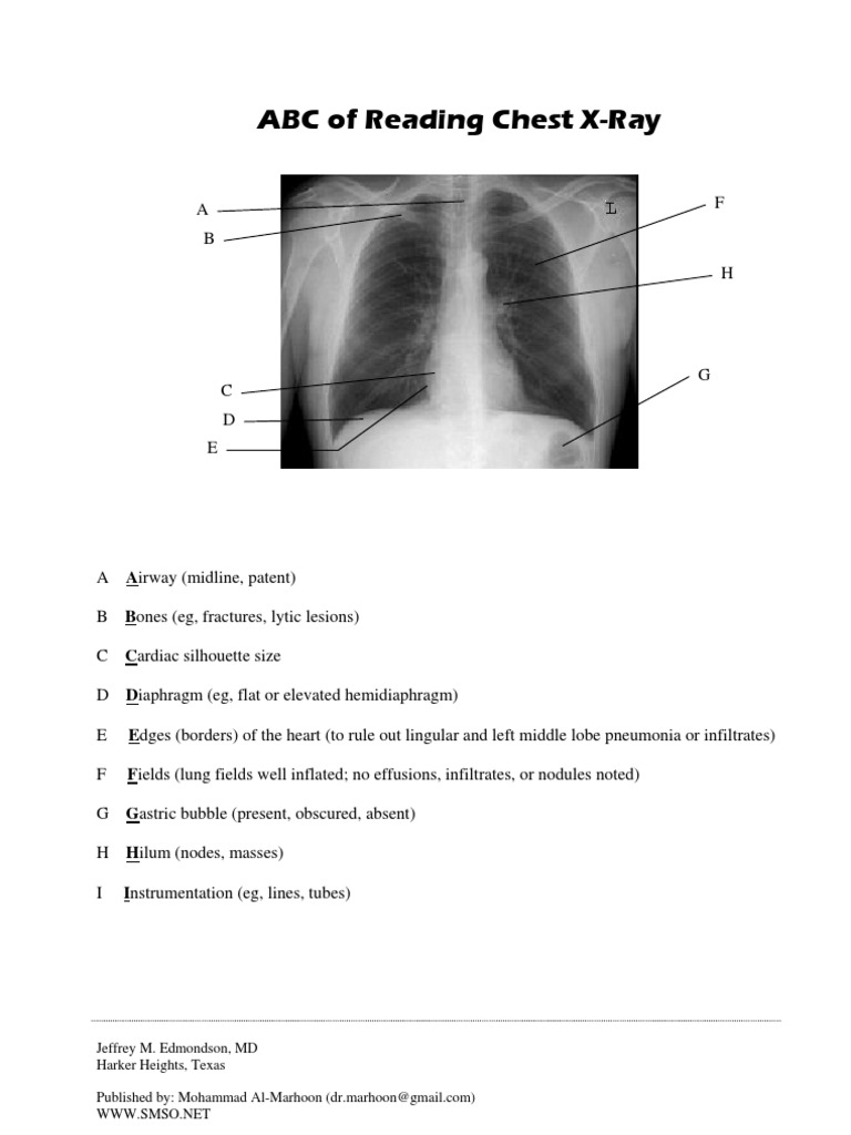 ABC of Reading Chest Xray | PDF | Organ (Anatomy) | Respiratory System