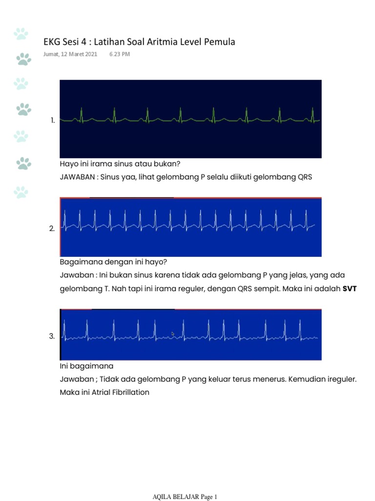 EKG Sesi 4 Latihan Soal Aritmia Level Pe | PDF