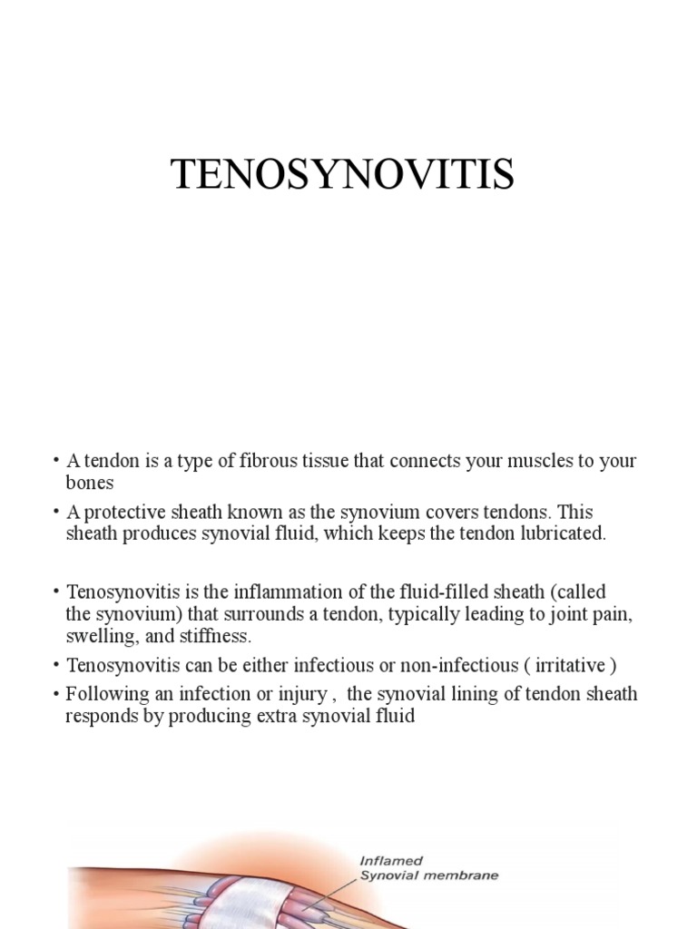 Finger Tenosynovitis Treatment Guide | PDF | Wellness