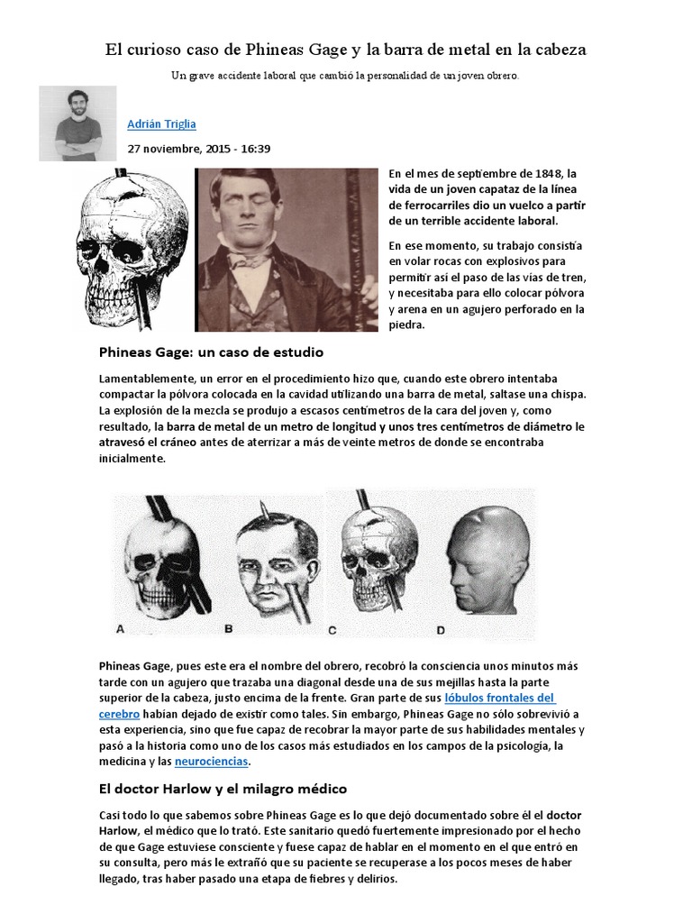 El Curioso Caso de Phineas Gage y La Barra de Metal en La Cabeza | PDF ...