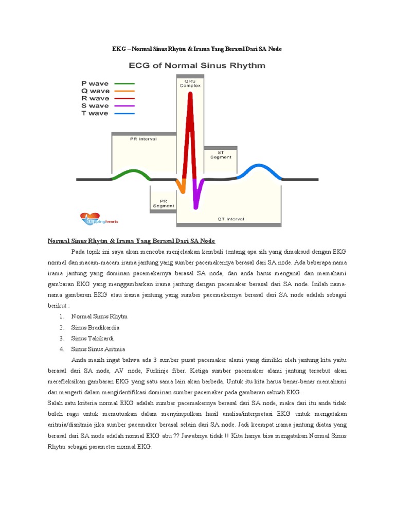 EKG Normal Sinus Rhythm dan Variannya | PDF