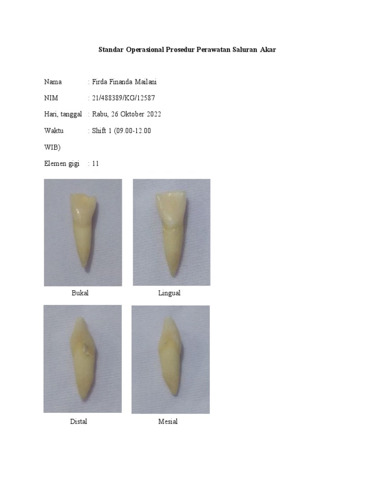 SOP MJ Inti Pasak Fiber | PDF
