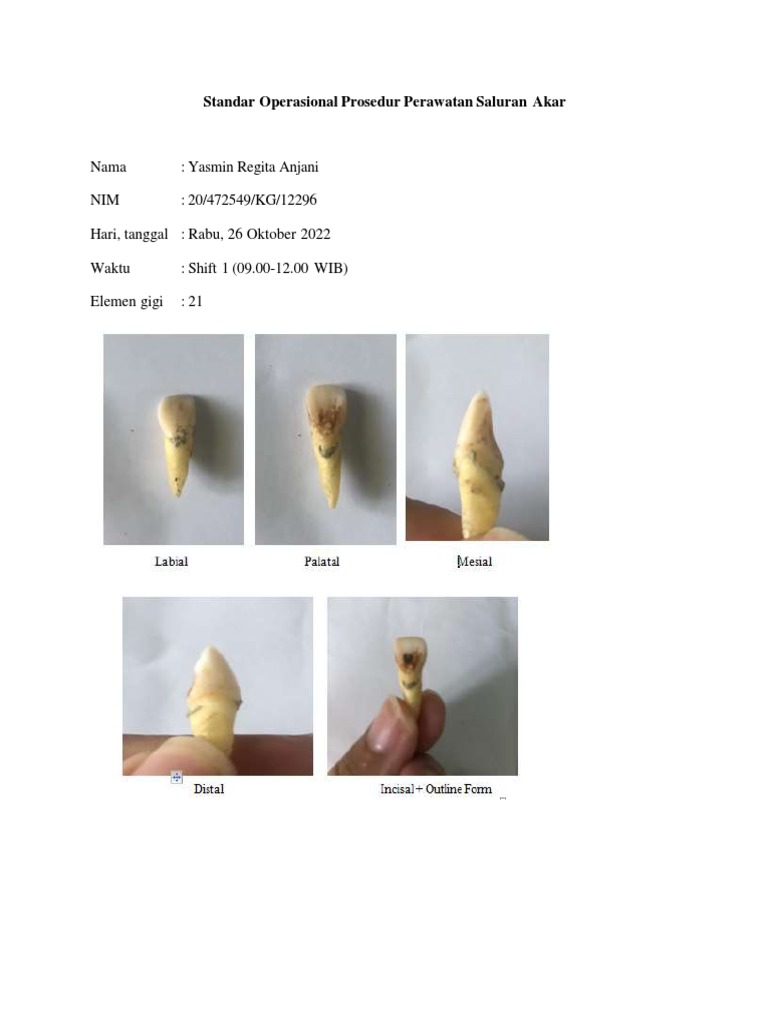 SOP MJ Inti Pasak Fiber | PDF