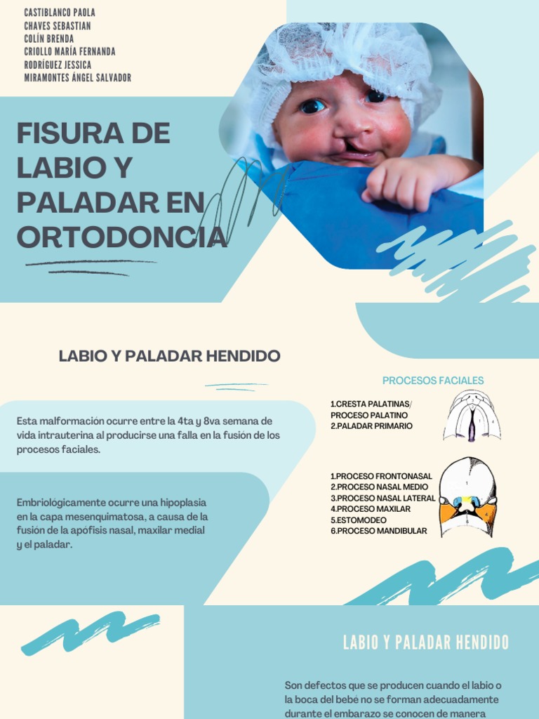 Fisura de Labio y Paladar | PDF | Ortodoncia | Odontología