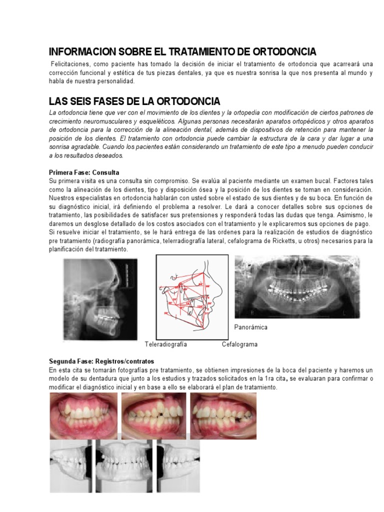 Las Seis Fases DEL TRATAMIENTO DE ORTODONCIA | PDF | Ortodoncia | Ramas de Odontología
