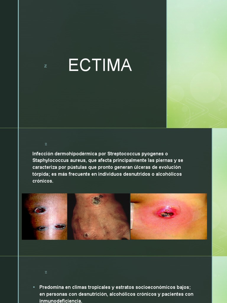 Ectima | PDF | Medicina | Epidemiología