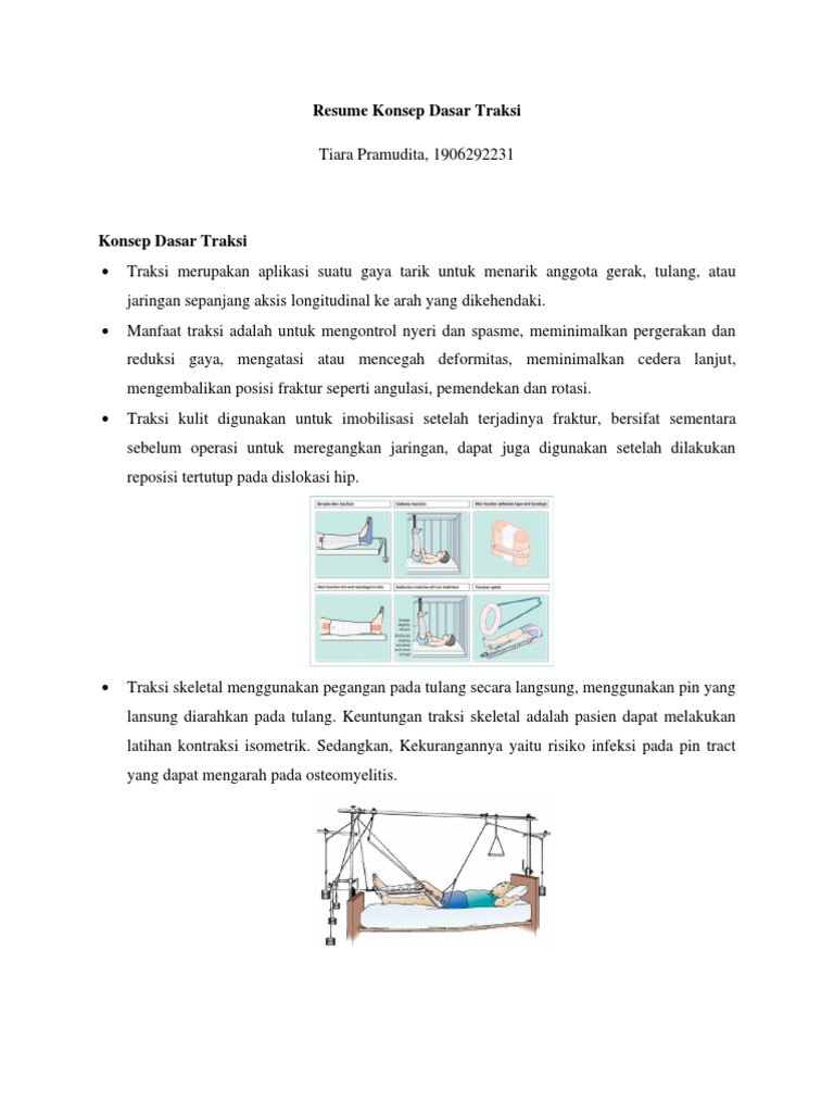 Tiara Pramudita - 1906292231 - Resume Konsep Dasar Traksi | PDF | Sains ...