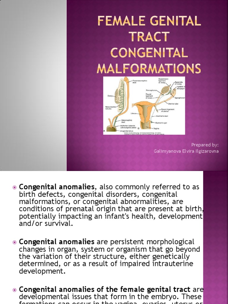 Female Genital Tract Congenital Malformations Pdf Uterus Vagina