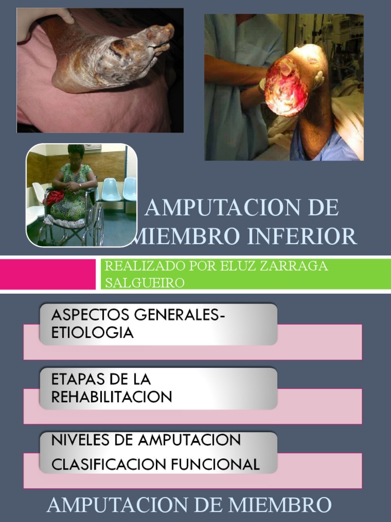 Amputacion de Miembro Inferior - PPT Eluz Version Imprimir | PDF ...
