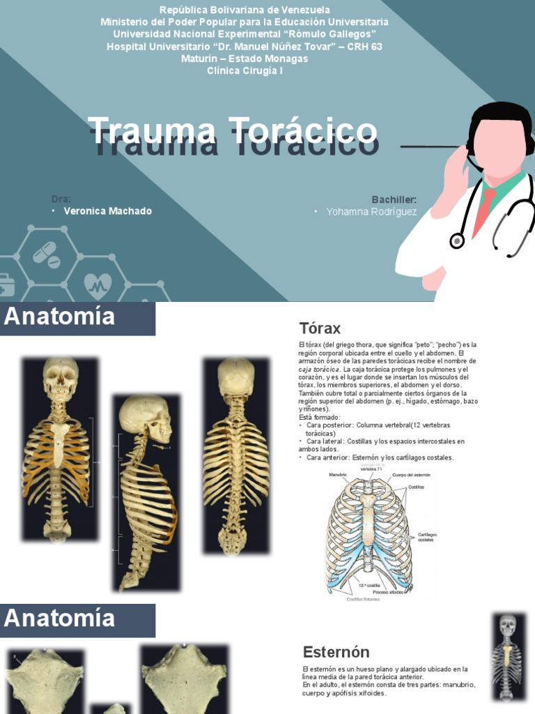 Trauma Toracico | PDF | Tórax | Vértebra