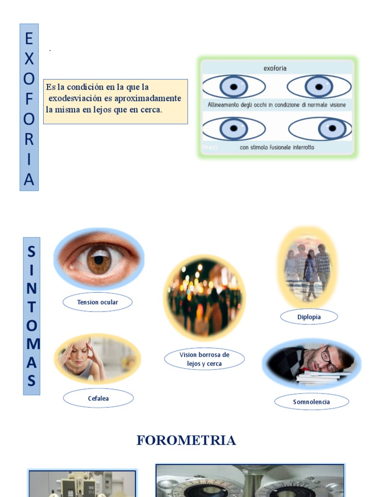 Exoforia Concepto Sintomas y Forometria | PDF