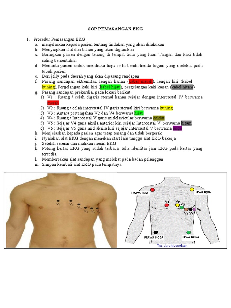 Sop Pemasangan Ekg | PDF