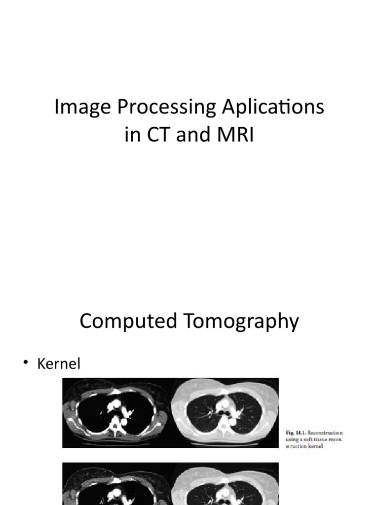 Image Processing CT Dan MRI | PDF
