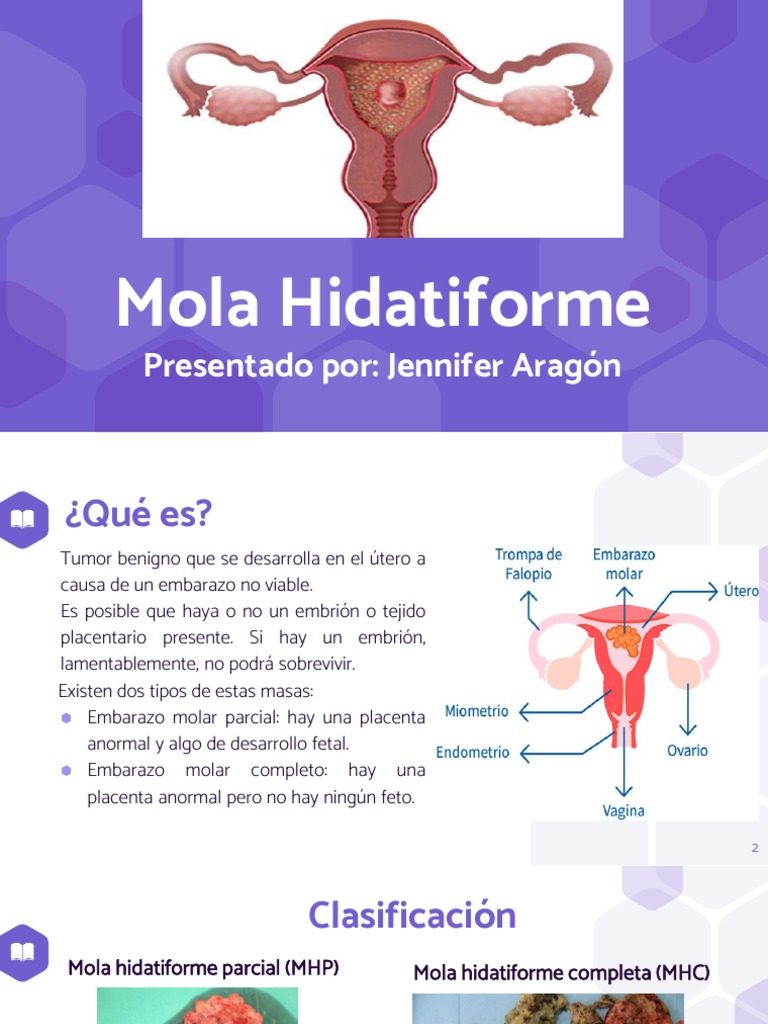 Mola Hidatiforme: Tipos y Síntomas | PDF | El embarazo | Epidemiología