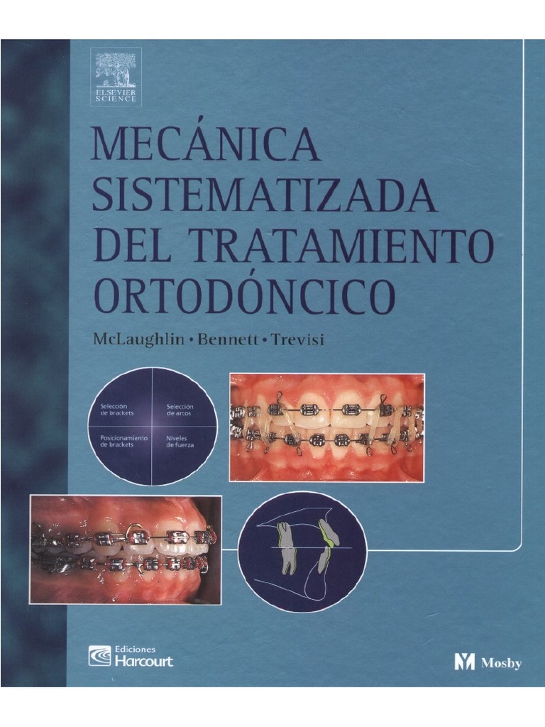 Libro MBT Mecanica Sistematizada Del TX Ortodontico | PDF