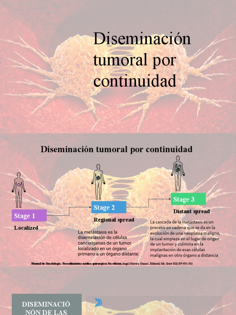 Diseminacion | PDF | Cáncer | Metástasis