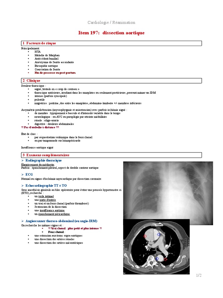 Dissection aortique : diagnostic et prise en charge | PDF | Aorte ...