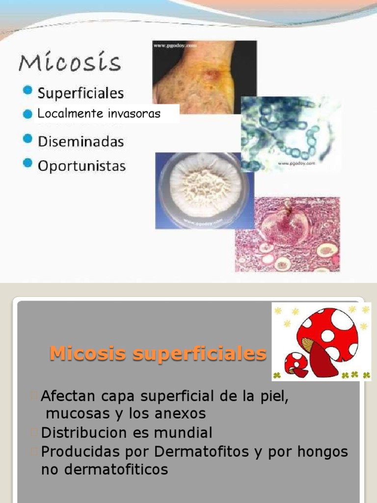 Micosis Superficial 2 | PDF | Inmunología | Medicina CLINICA