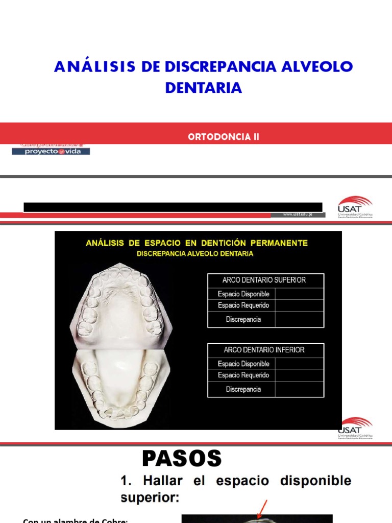 Análisis de Discrepancia Alveolo Dentaria | PDF