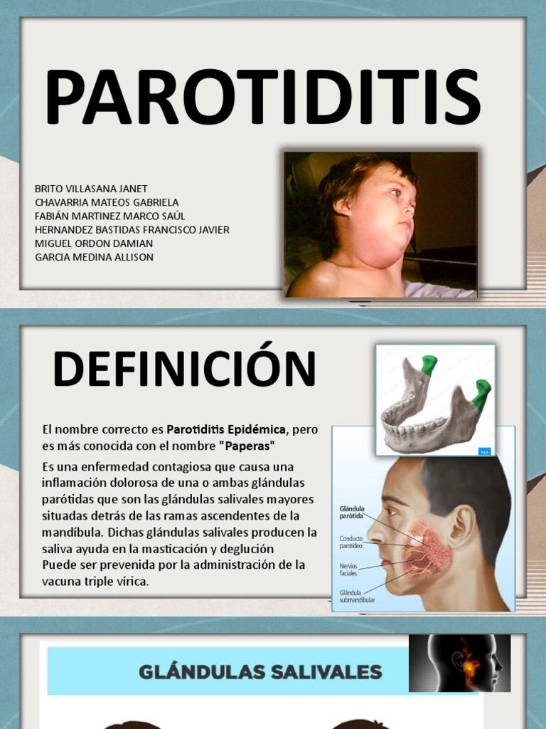 Parotiditis en Adultos: Diagnóstico y Tratamiento | PDF | Inmunología ...