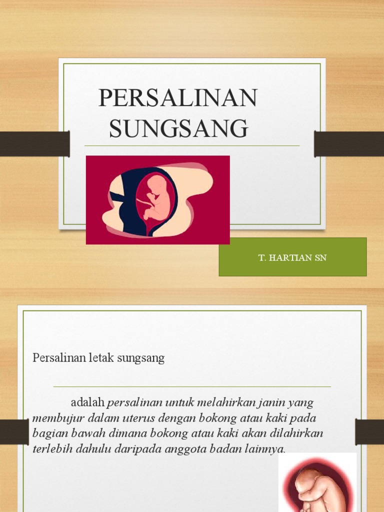 Persalinan Sungsang | PDF