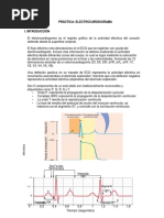 Infradesnivel y Supra del ST en ECG | PDF