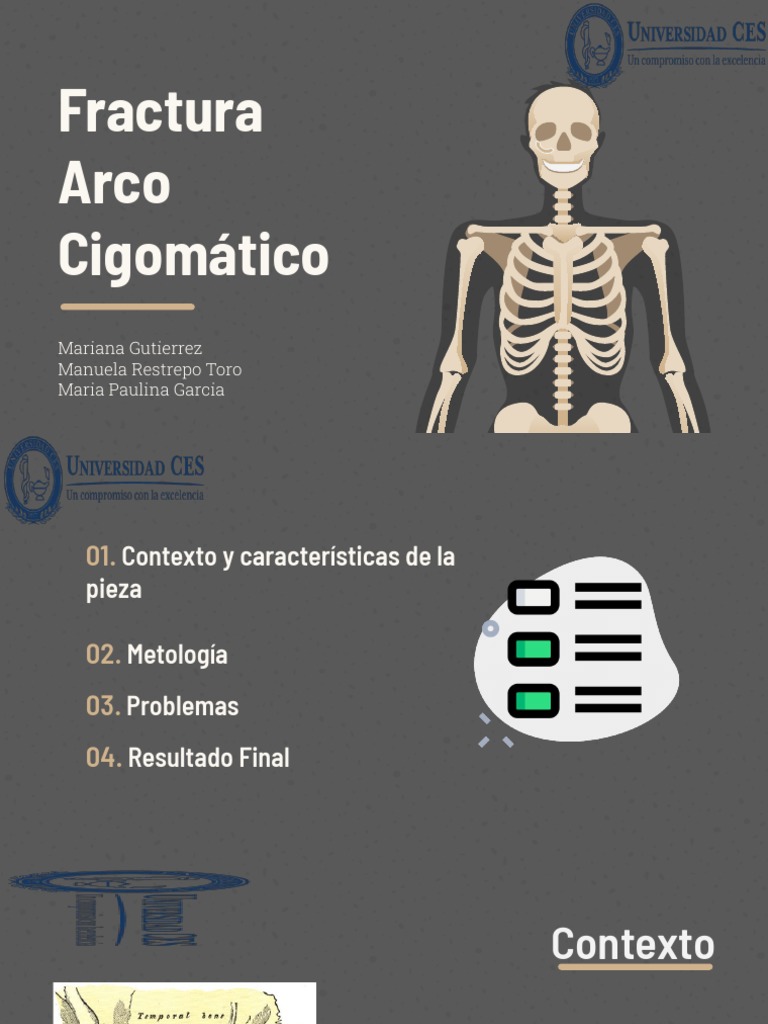 Arco Cigomatico | PDF | Sistema esquelético | Cabeza y cuello humanos