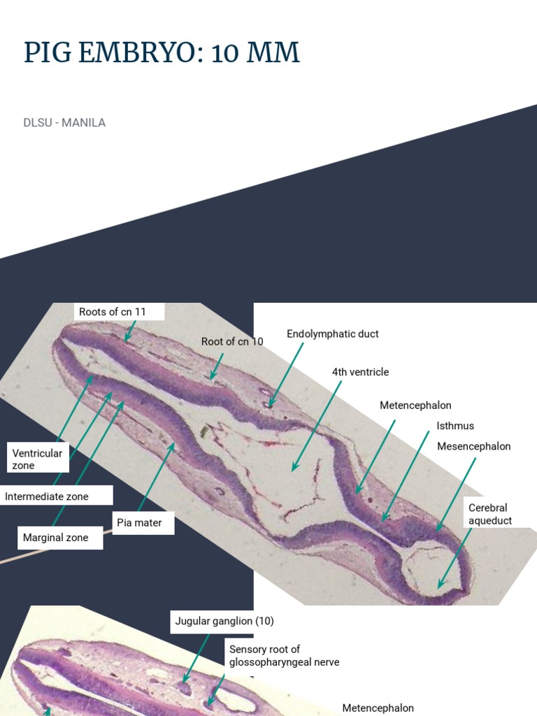 Labeled Structures of 10mm Pig Embryo | PDF | Aorta | Liver