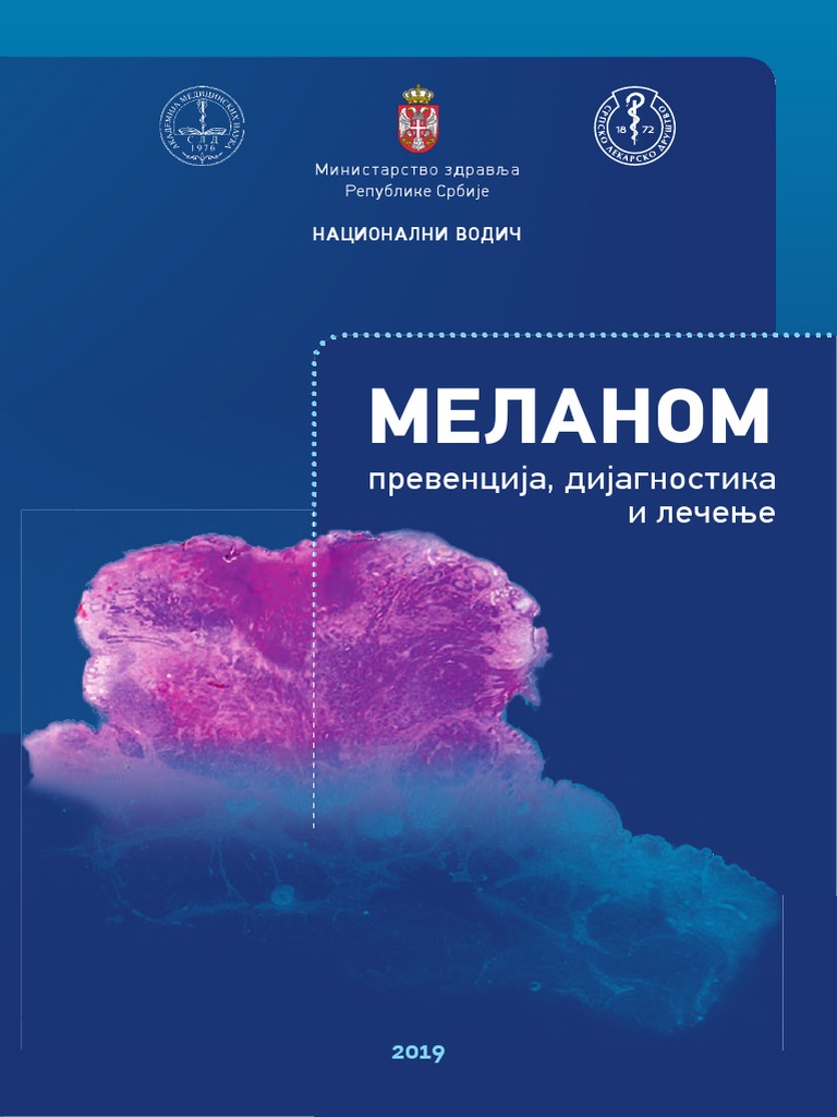 Nacionalni Vodic Melanom CIR - MAJ2019 | PDF