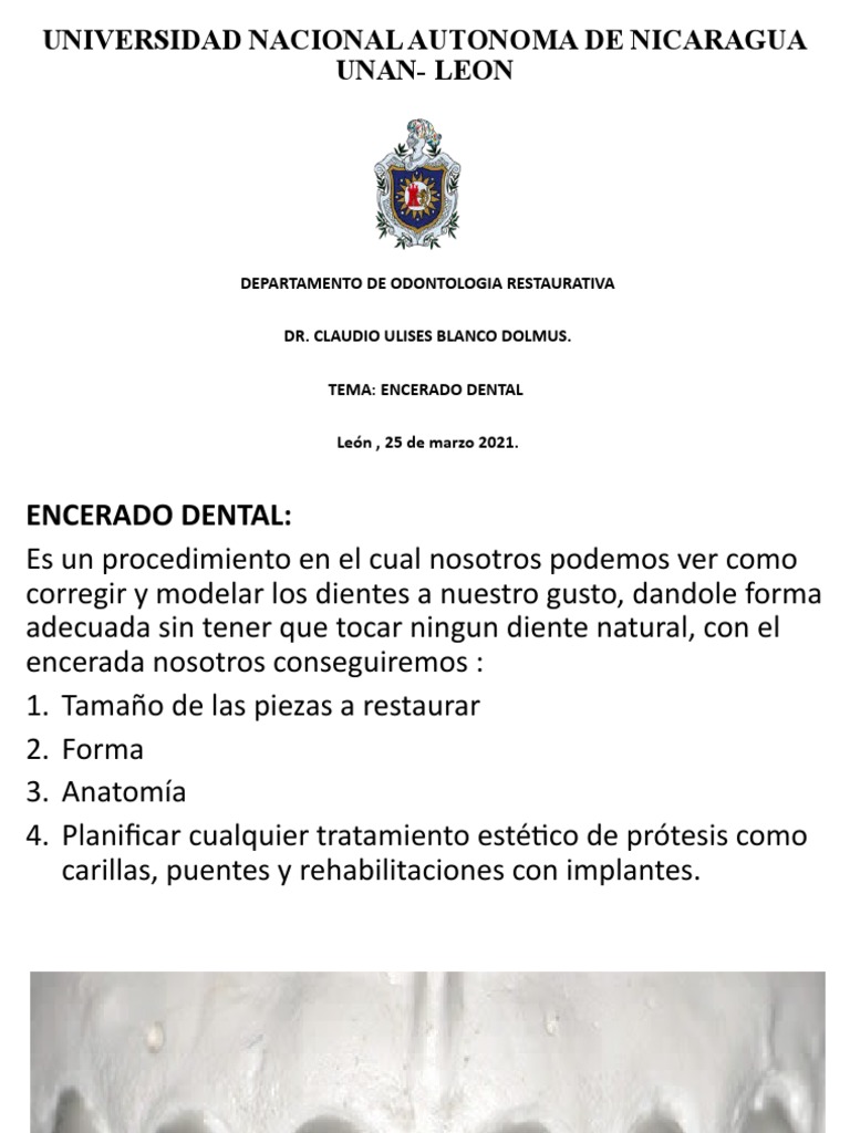 Ventajas del Encerado Dental | PDF | Dentadura postiza | Odontología