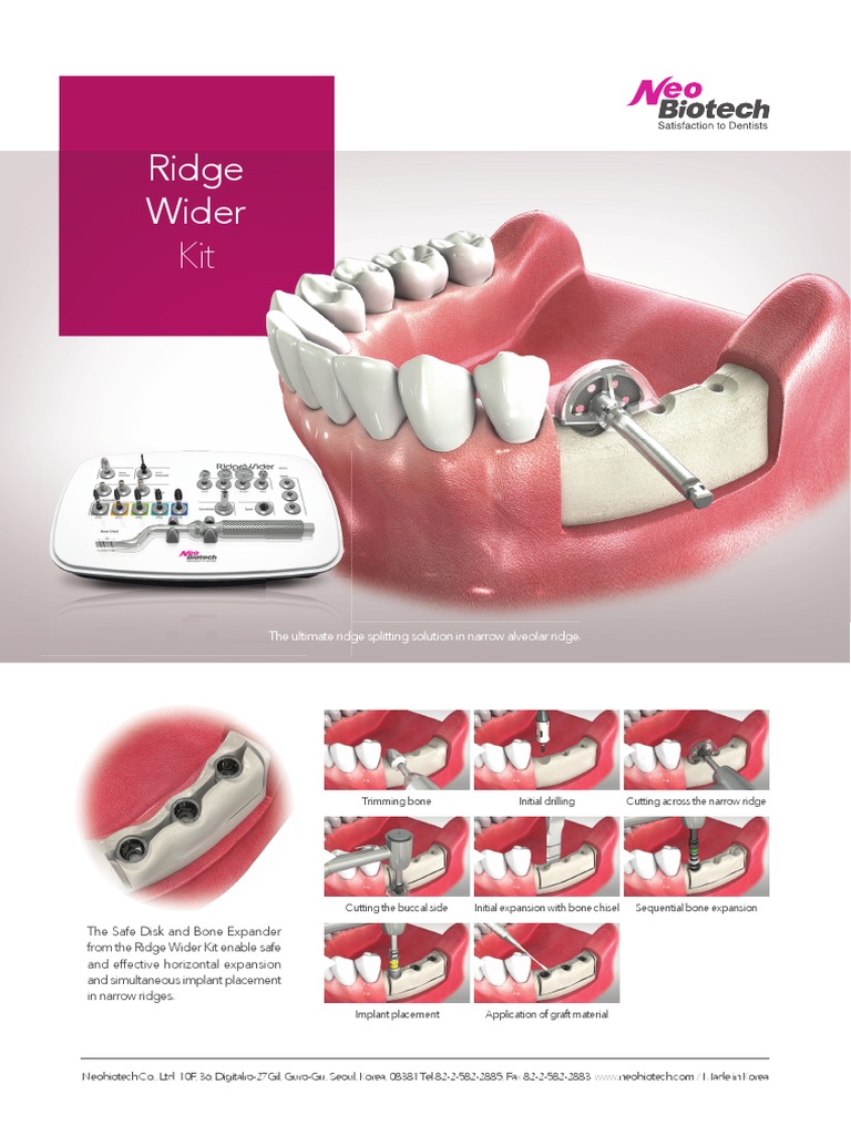 Ridge Wider Kit Leaflet - 20.01.13 | PDF | Manufactured Goods ...