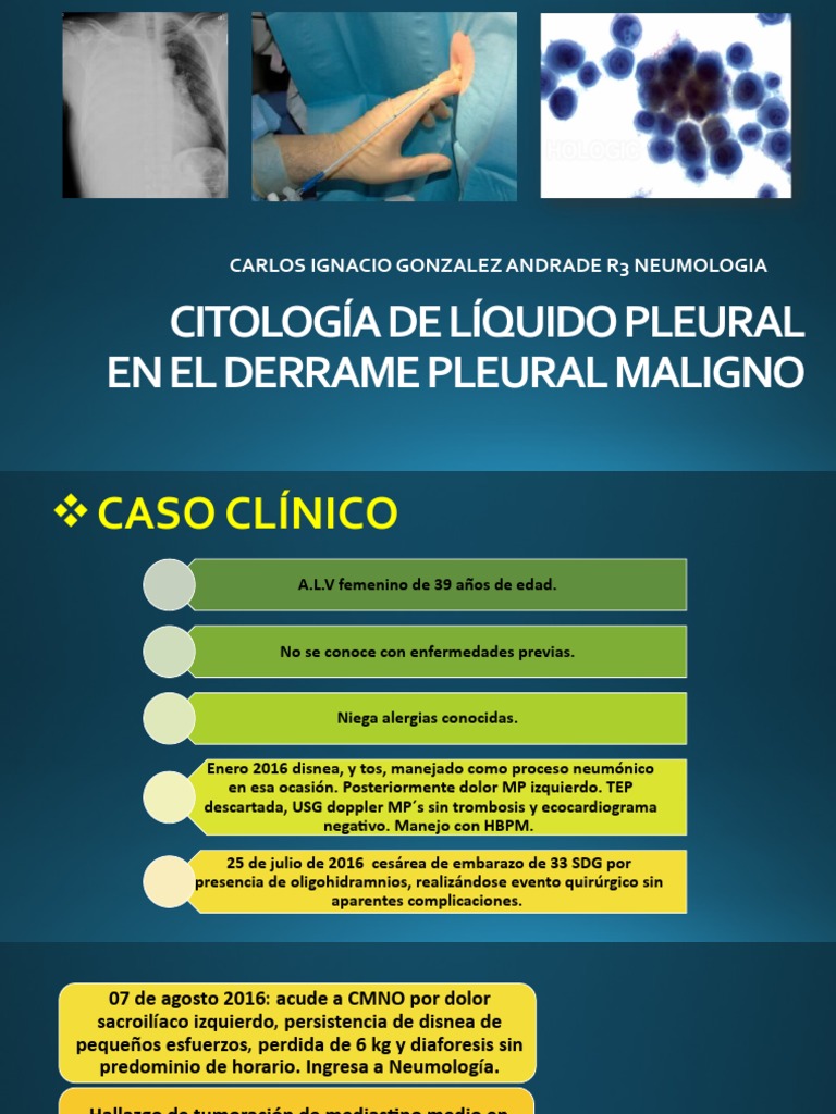 CITOLOGÍA DE LÍQUIDO PLEURAL | PDF | Biopsia | Cáncer