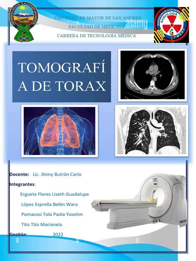 Tomografia de Torax Con Contraste | PDF | Ct Scan | Ventrículo (corazón)
