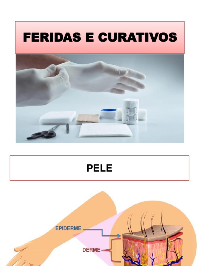 Feridas e Curativos | PDF | Queimadura | Pele