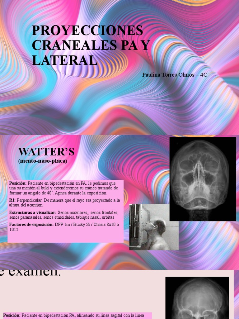 Proyecciones Craneales en Pa y La | PDF | Anatomía humana | Cabeza y ...