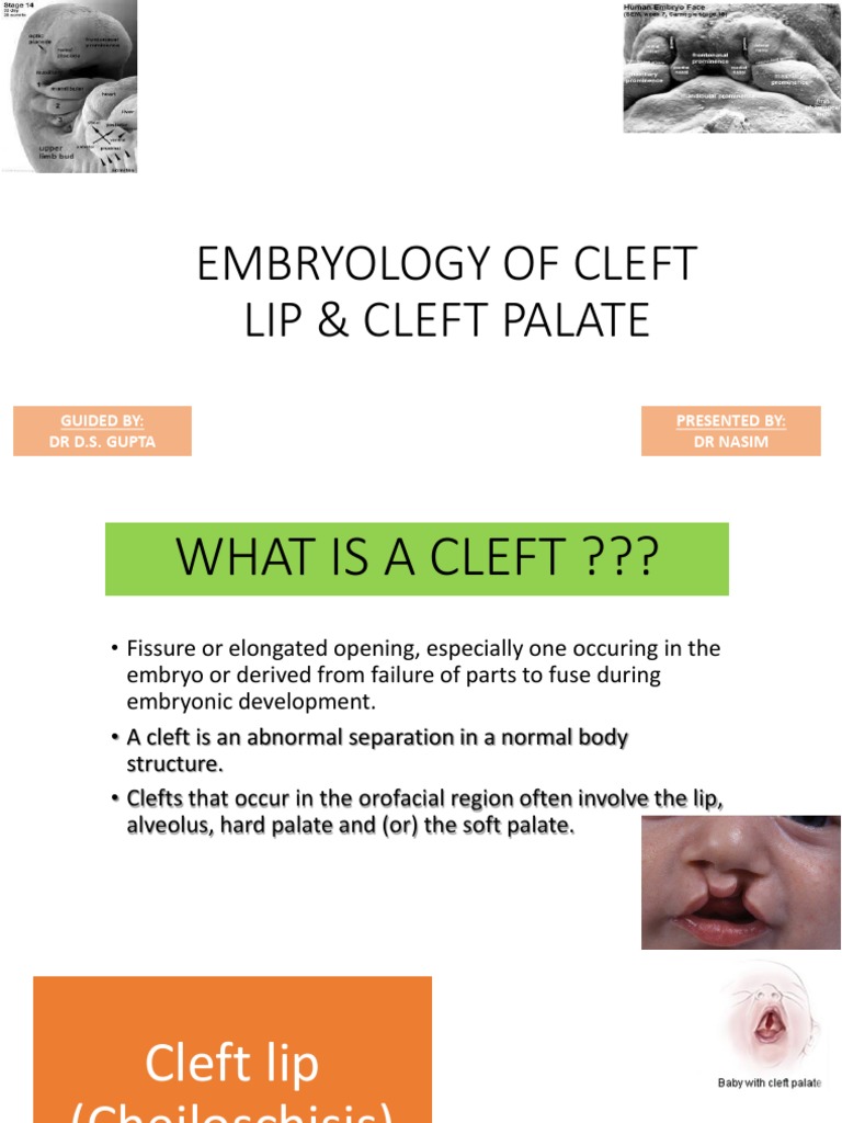 Embryology of Cleft Lip and Palate | PDF | Human Head And Neck | Anatomy