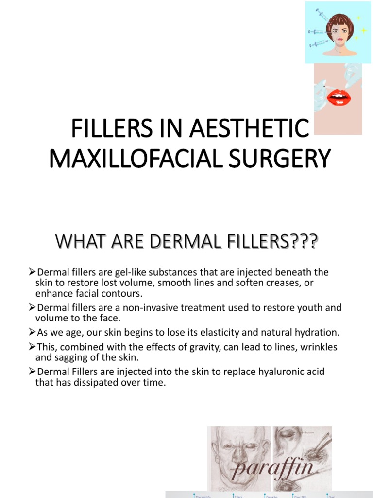 Fillers in Aesthetic Maxillofacial Surgery | PDF | Plastic Surgery ...